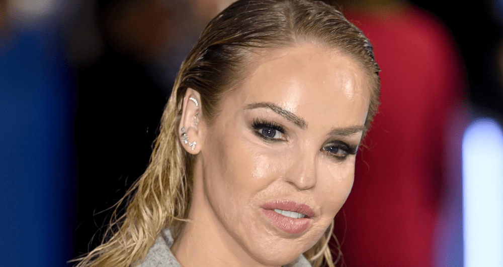 Katie Piper OBE Still Beautiful